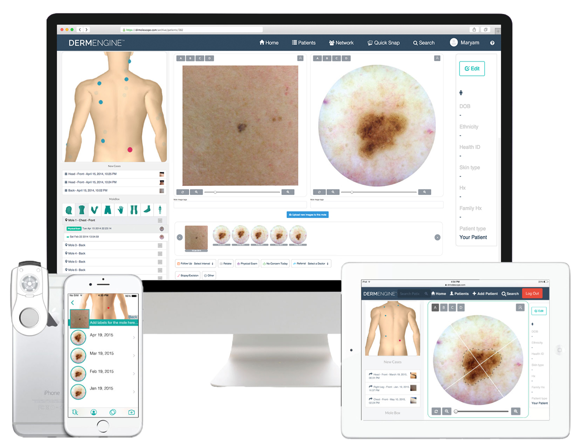 MoleScope™ | Skin screening made simple
